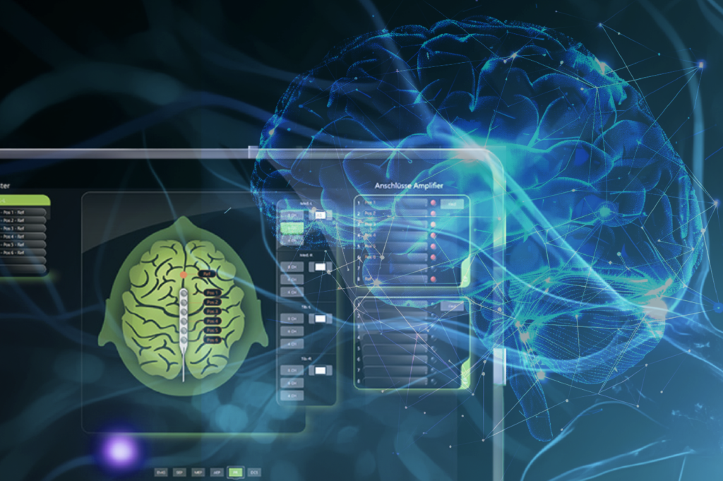 Phase Reversal - AxIOM Neuromonitoring