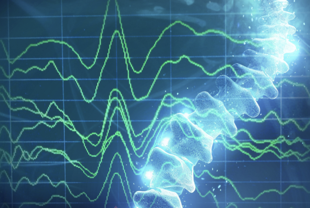 D-Wave Monitoring - AxIOM Neuromonitoring